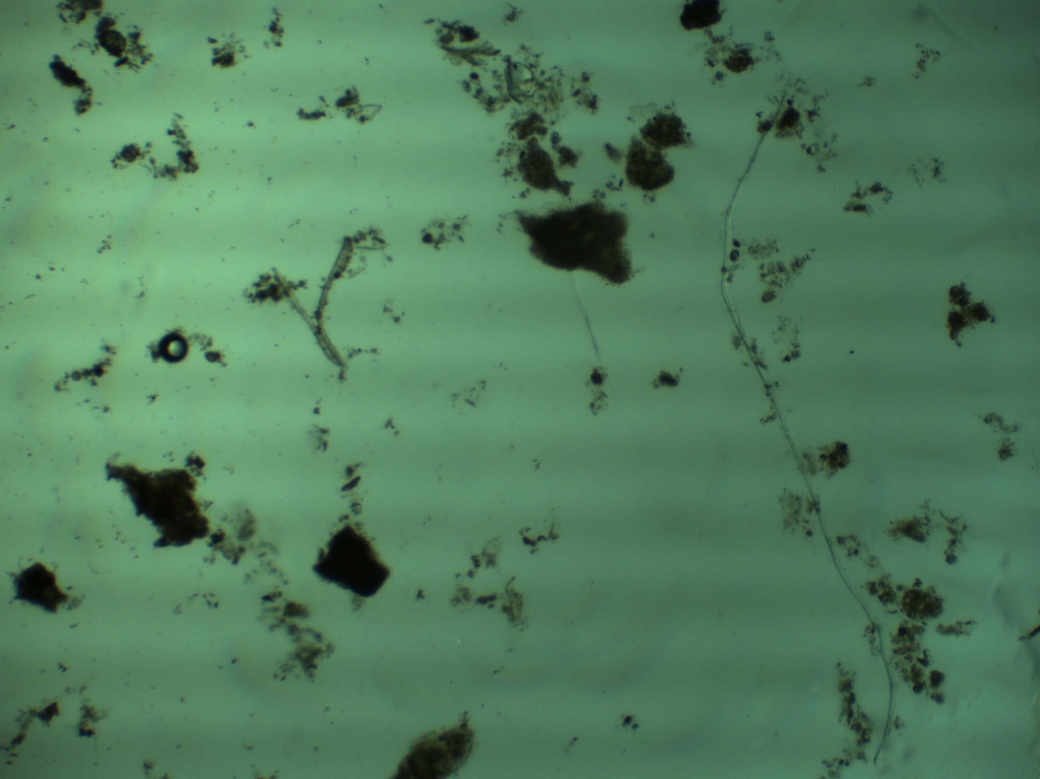 Classification of Indian Herbal Plants based on powder microscopic ...