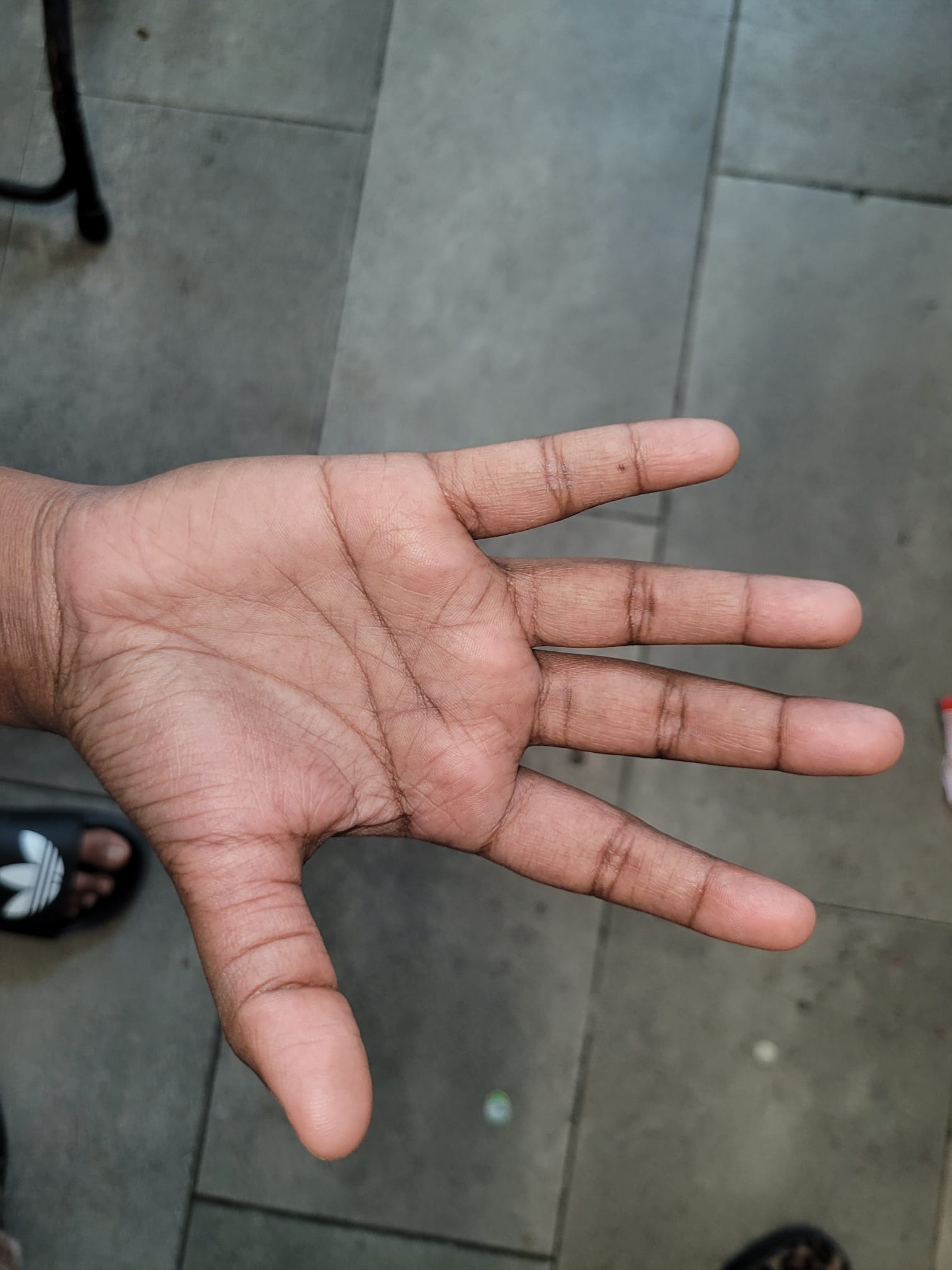 How to Use the detect bio Object Detection API