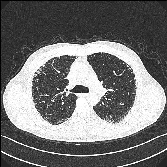 bal petegi Object Detection Dataset and Pre-Trained Model by ipf bal petei
