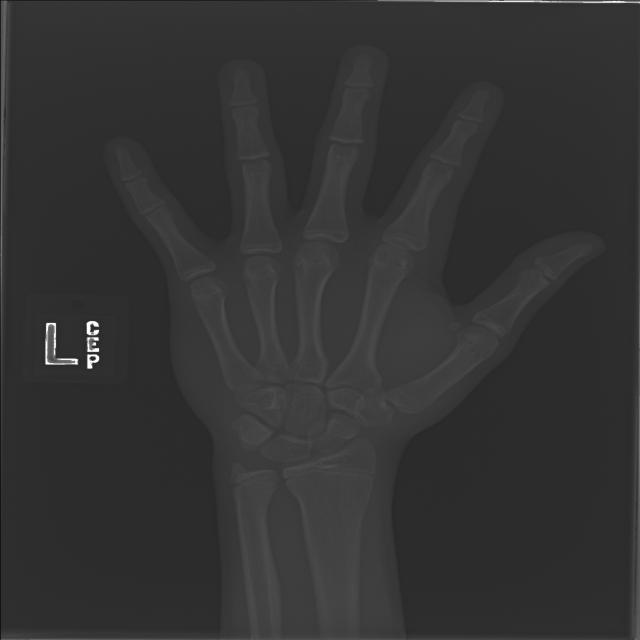 "Hand bones" Instance Segmentation Dataset and Pre-Trained Model by Universiti Malaya