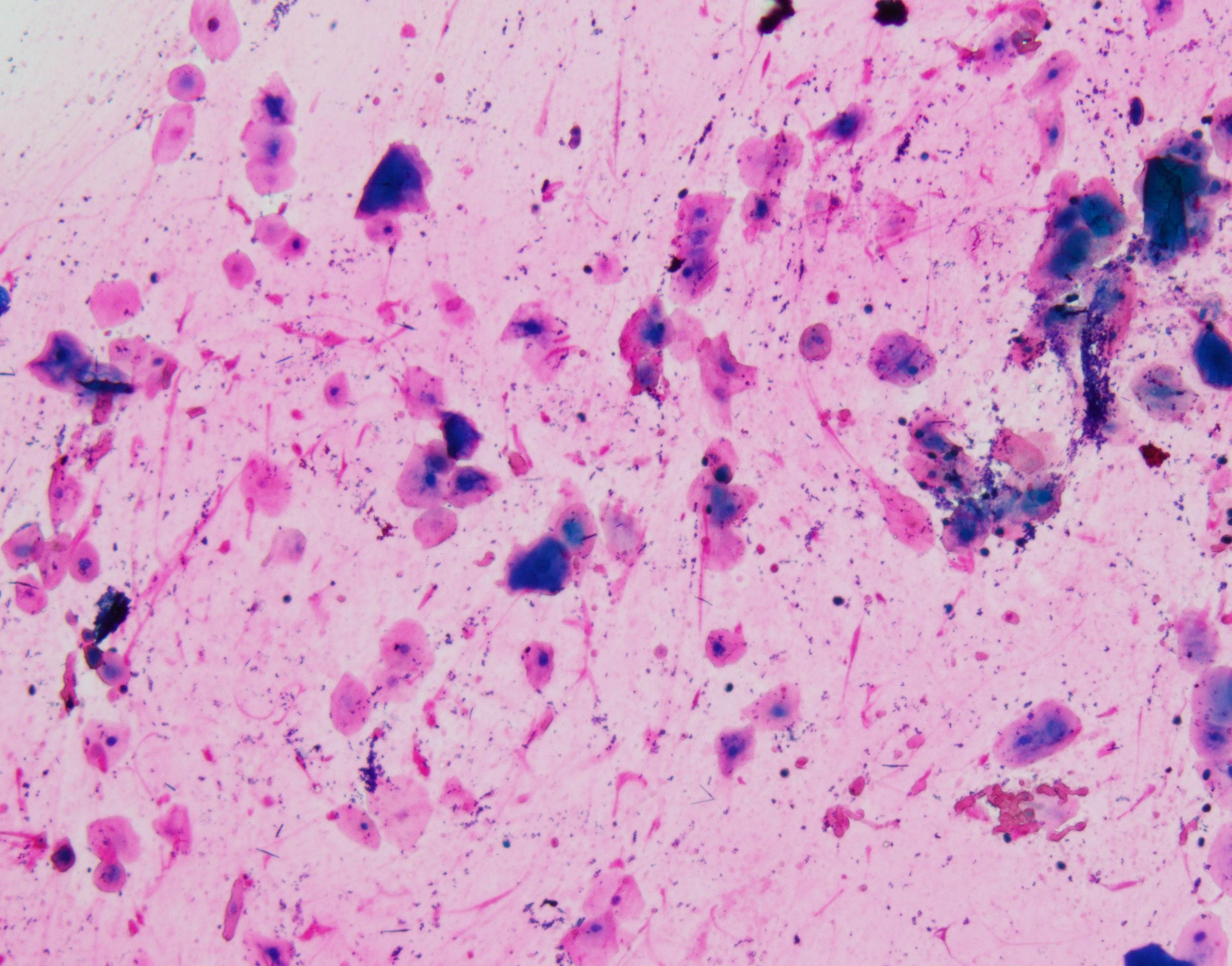 Geckler#7 Object Detection Dataset by Geckler