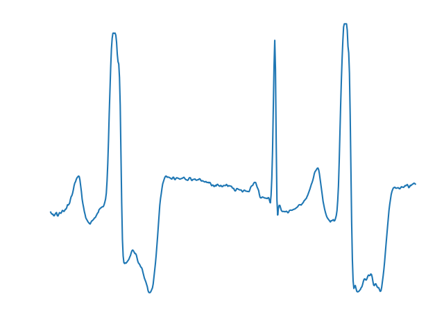 Bigem Detection Object Detection Dataset By Pvc