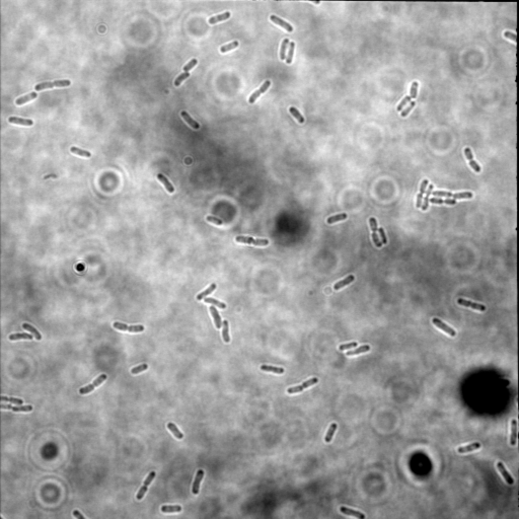 How To Use The Bacteria Detection V2 Object Detection Api