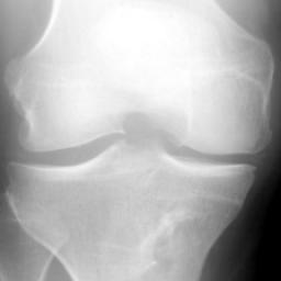 kneenet Classification Dataset by knee net