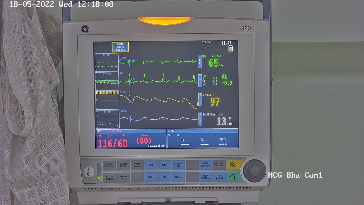 scren Object Detection Dataset by some