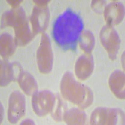 Zhopa Object Detection Dataset by Moe