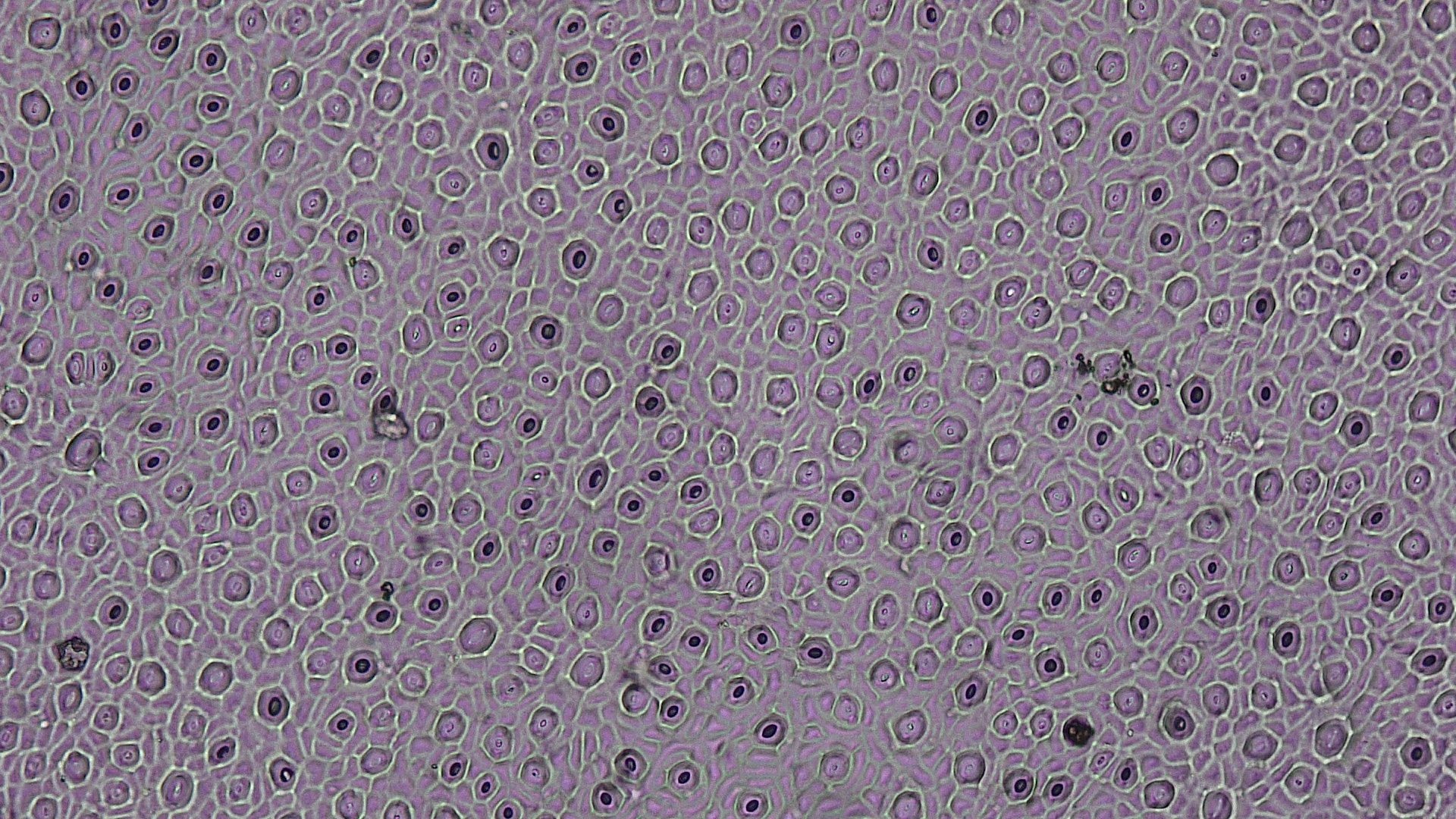 Stomacounter Object Detection Dataset By Stomata Counter