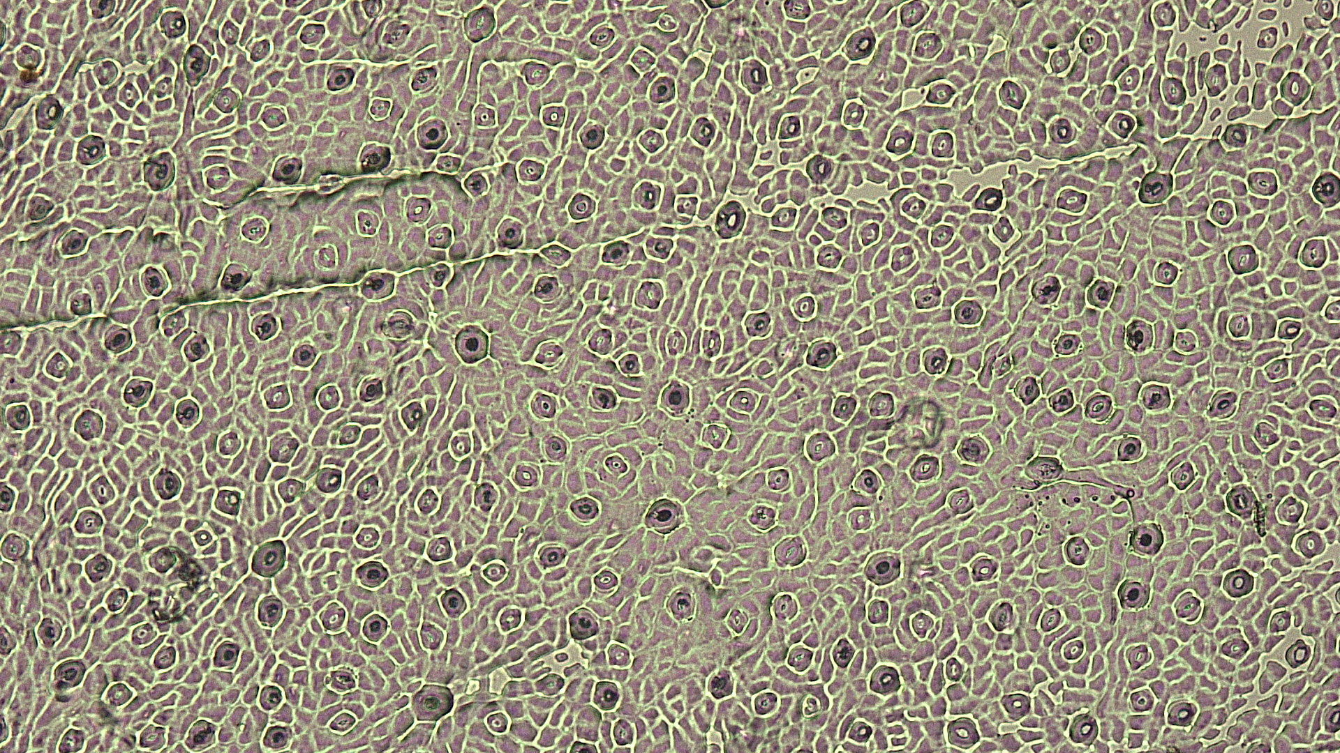 Stomacounter Object Detection Dataset And Pre Trained Model By Stomata