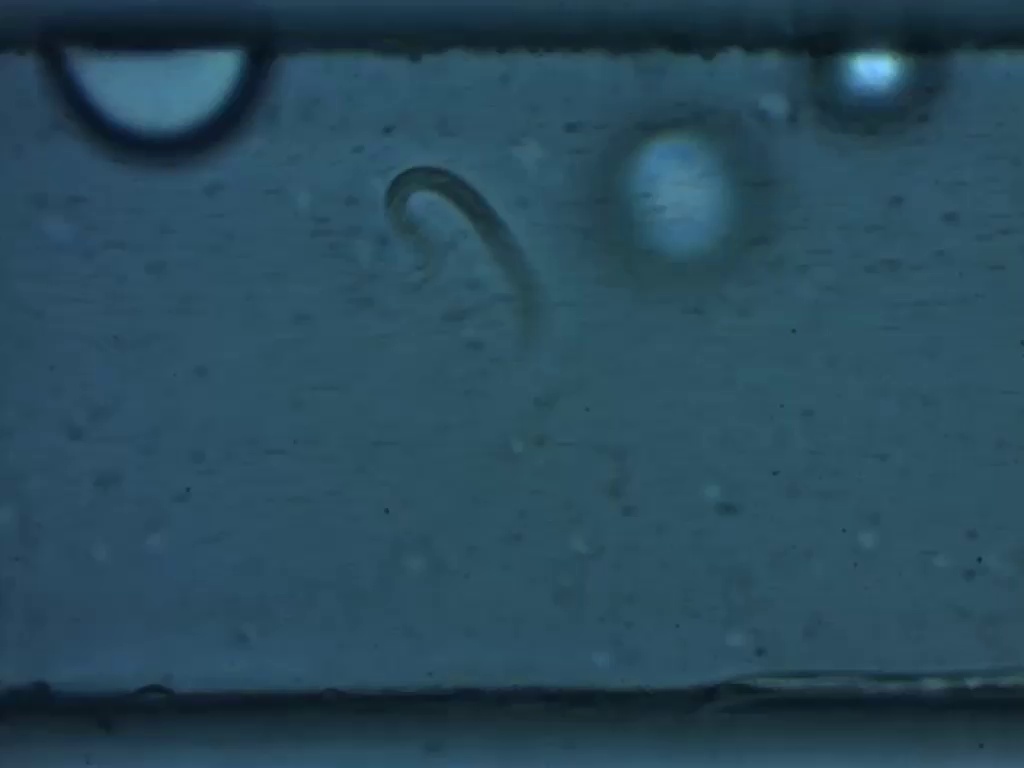 Worm Detection Project Object Detection Dataset and Pre-Trained Model by Project