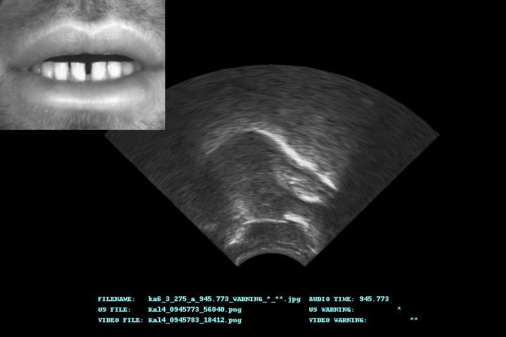 Vocal tract ultrasound image detector Instance Segmentation Dataset by Adarsh Muru
