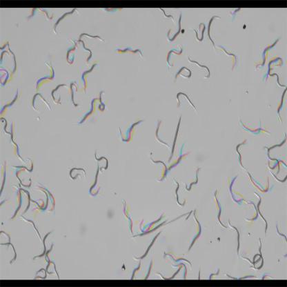 Nematode Object Detection Dataset by Nematode