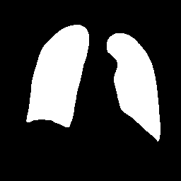 LUNG CANCER Object Detection Dataset by Increate hub