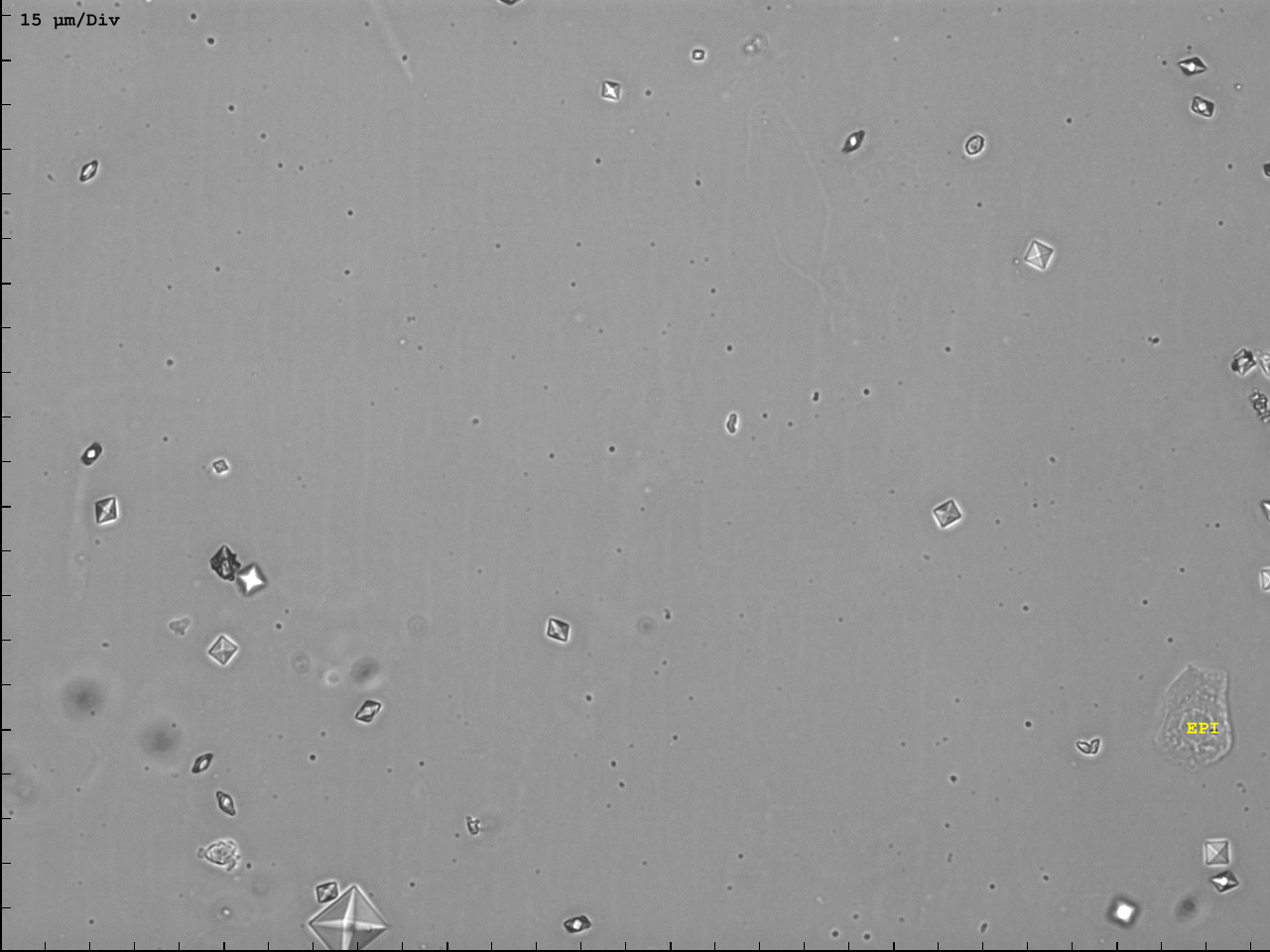 calcium v2 Object Detection Dataset and Pre-Trained Model by USED