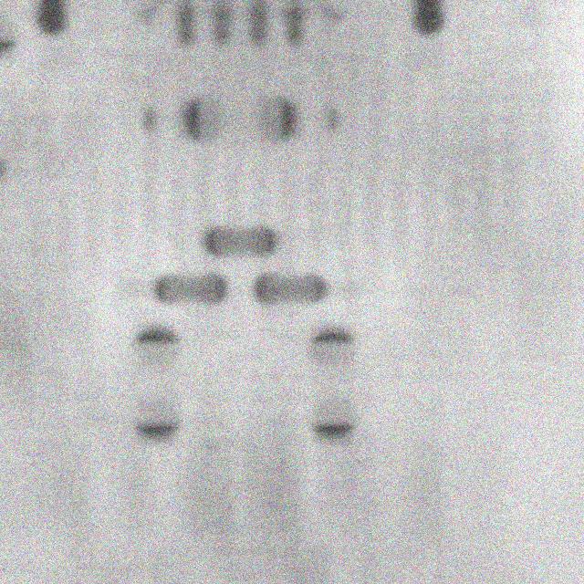 SMT-Res Defects Detection on AXI Object Detection Dataset and Pre-Trained Model by FYP