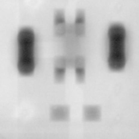 Roboflow SMT-Res Augmented Dataset Object Detection Dataset and Pre-Trained Model by FYP