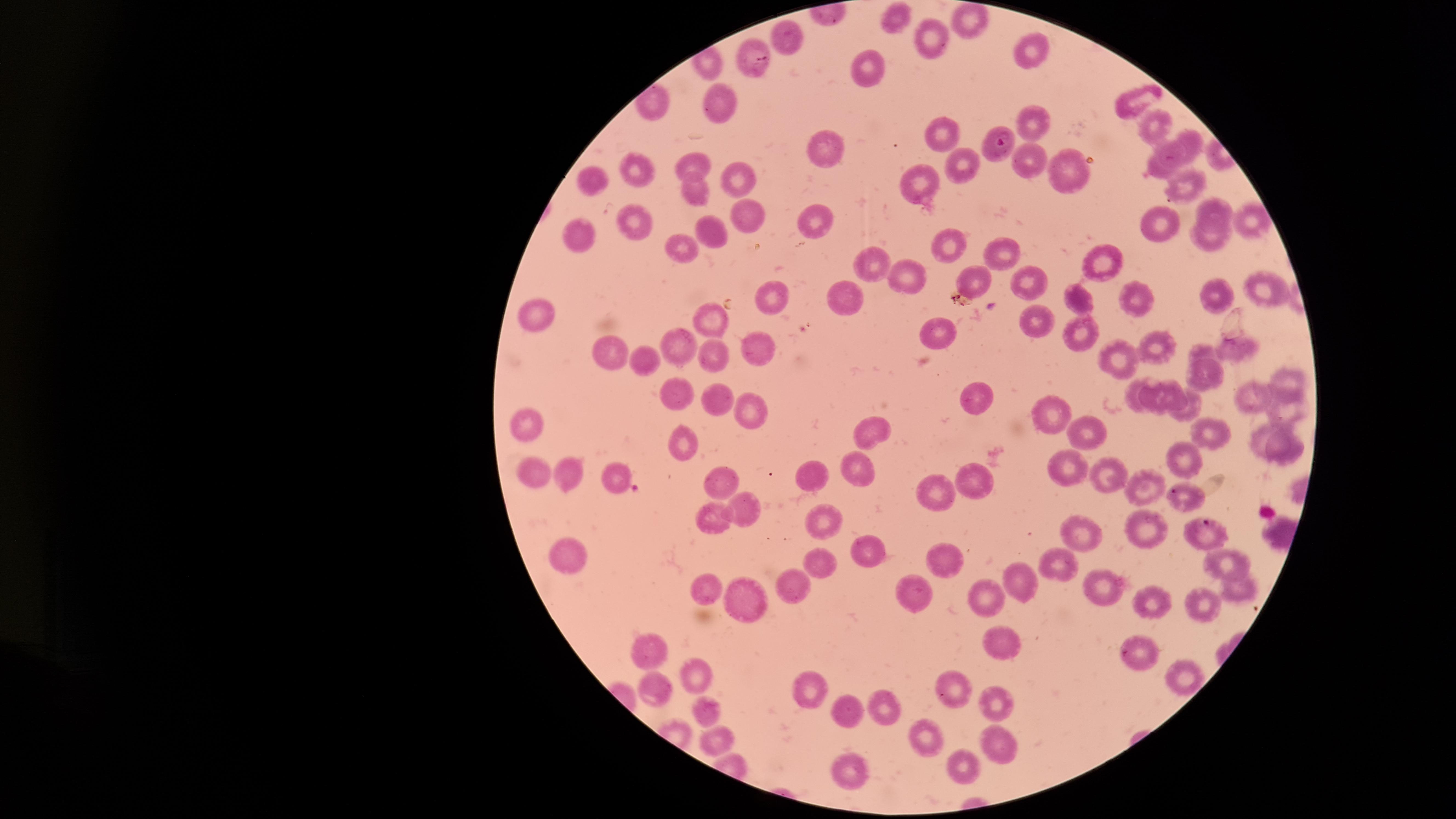 How to Use the malaria infection Object Detection API