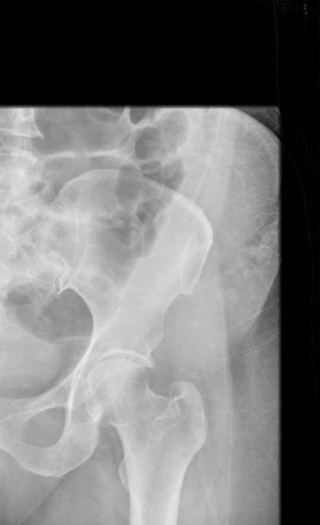 bone Classification Dataset and Pre-Trained Model by college