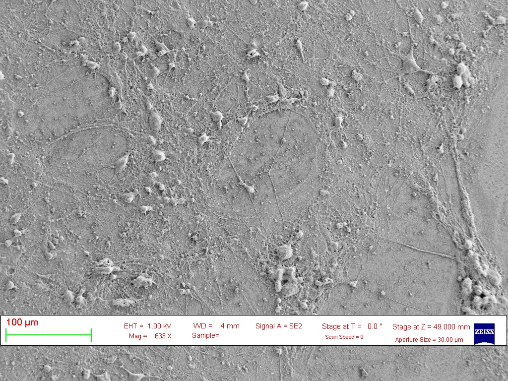 Plotting Scale Detection Object Detection Dataset And Pre Trained Model