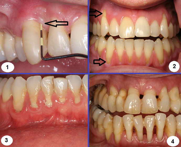 Dental Module - Roboflow Universe