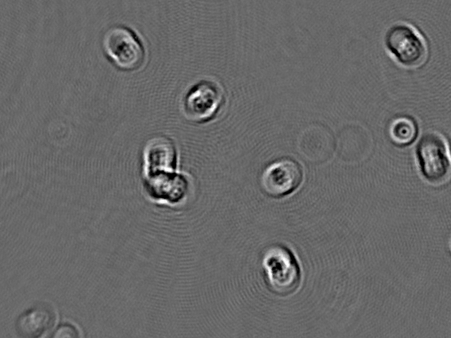 bacterial_only Object Detection Dataset by Abha Gejji