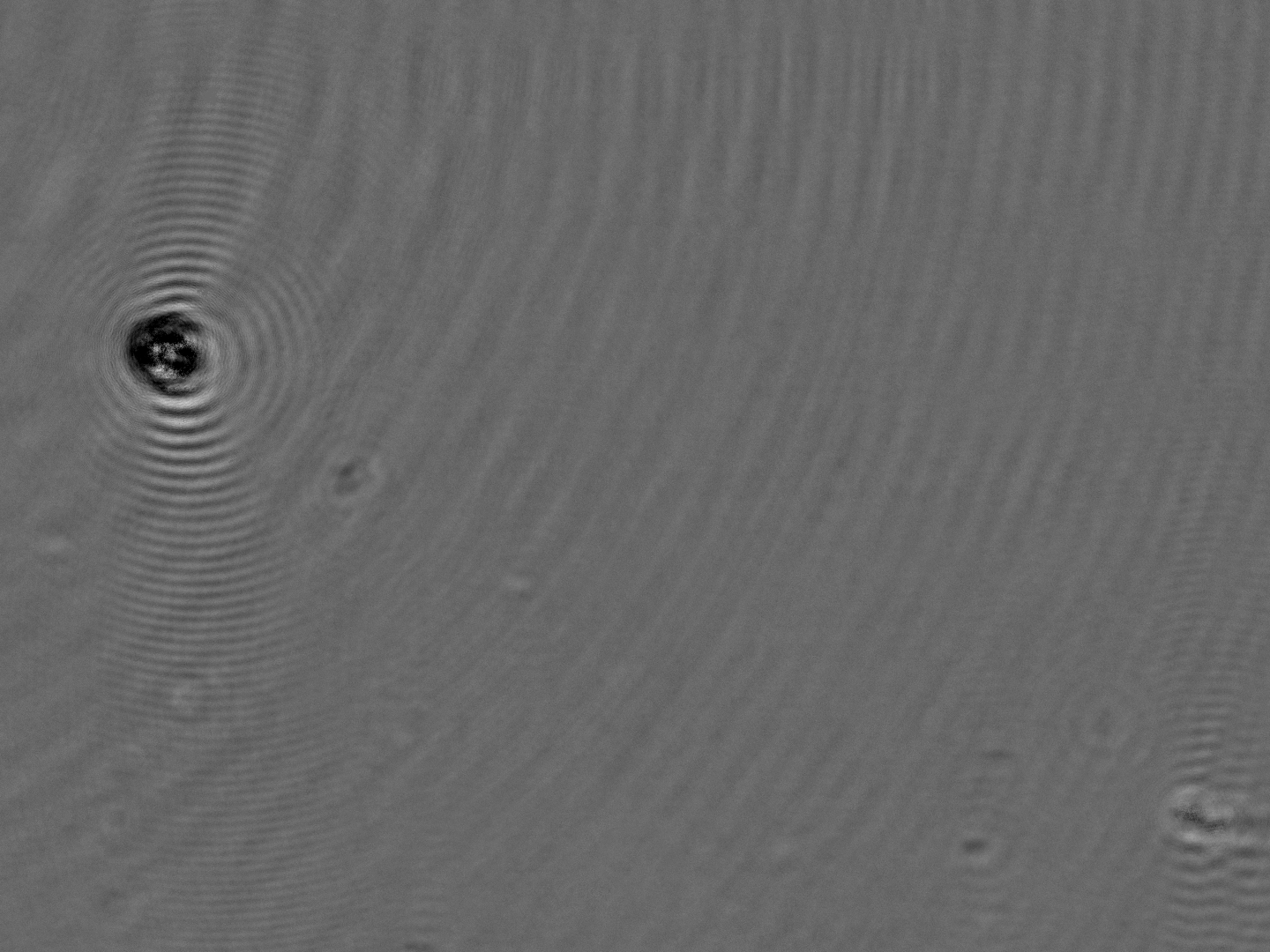Bacteria Lager Set1 Object Detection Dataset By Abha Gejji