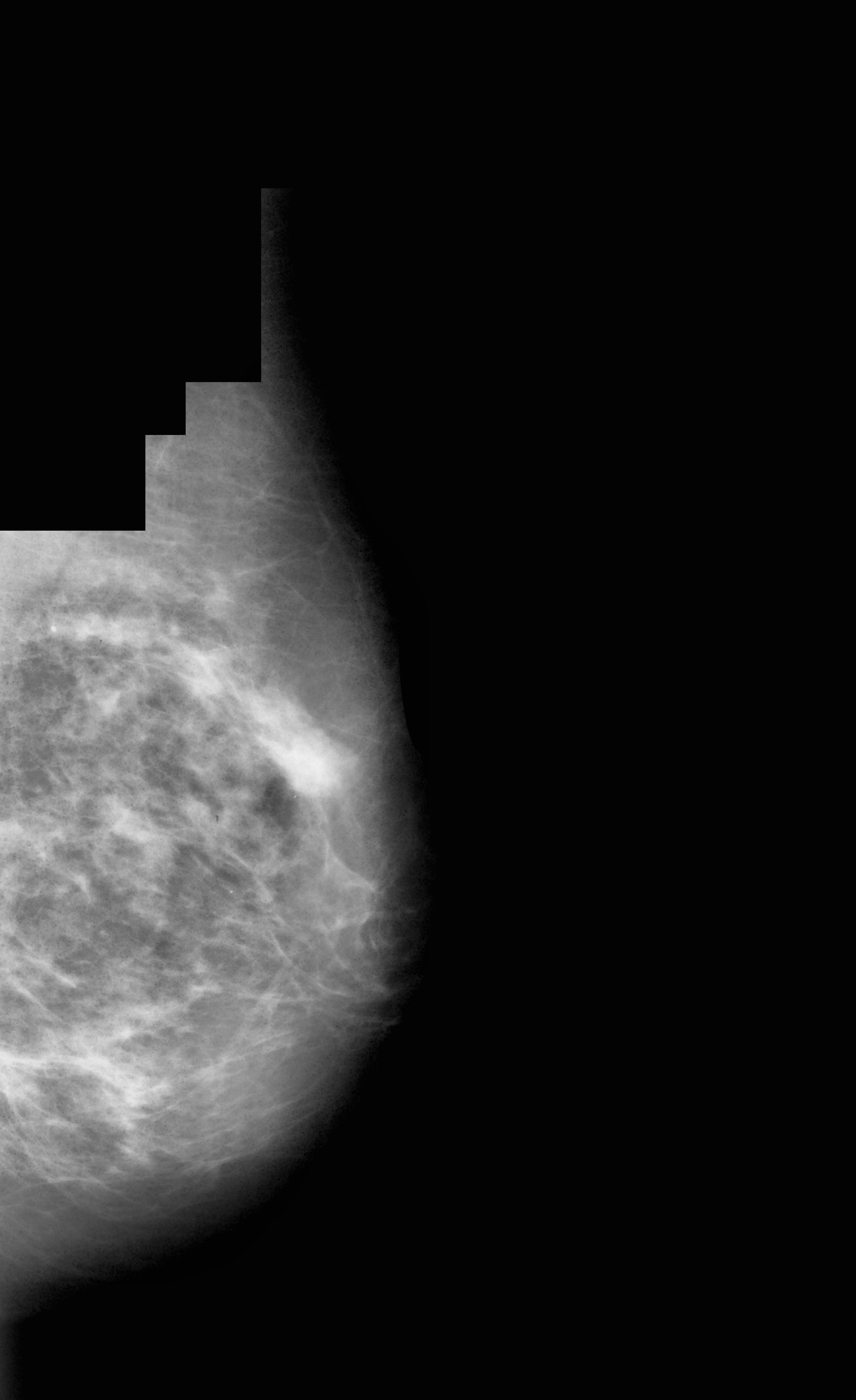 Preprocessing Tumor Object Detection Dataset V1 2023 08 06 4 31pm By