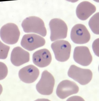 malaria_detection Object Detection Dataset by yolo5objectdetection