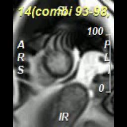 cardiac Object Detection Dataset and Pre-Trained Model by adadadadada