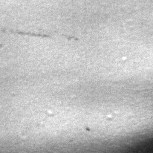 Pit Detection Computer Vision Dataset By Geun Woo Ban