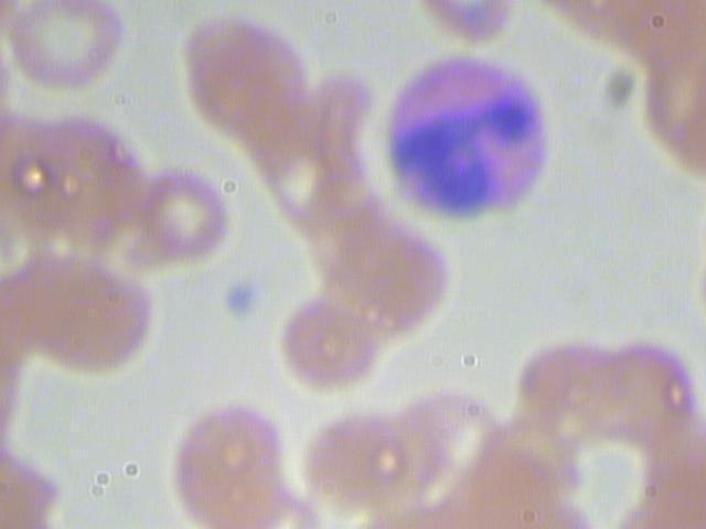 Bccd Object Detection Dataset By Yolov7 Test