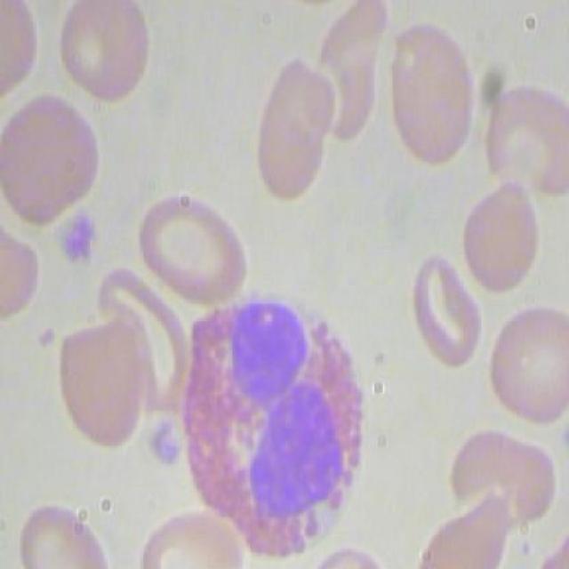 Data-train-blood-cell-detection-3 Object Detection Dataset by Nihars ...