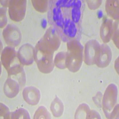 Blood Cell Detection Object Detection Dataset and Pre-Trained Model by ...