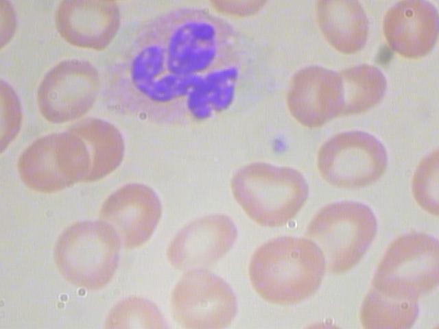 Blood Cell Detection Final Object Detection Dataset by Nihars Workspace