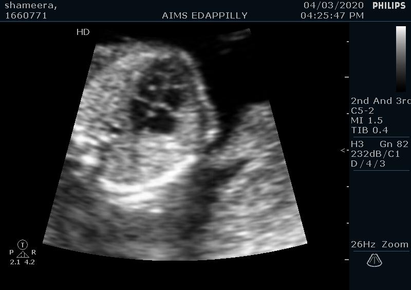 How to Use the Heart Fetus Ultrasound Images Instance Segmentation API