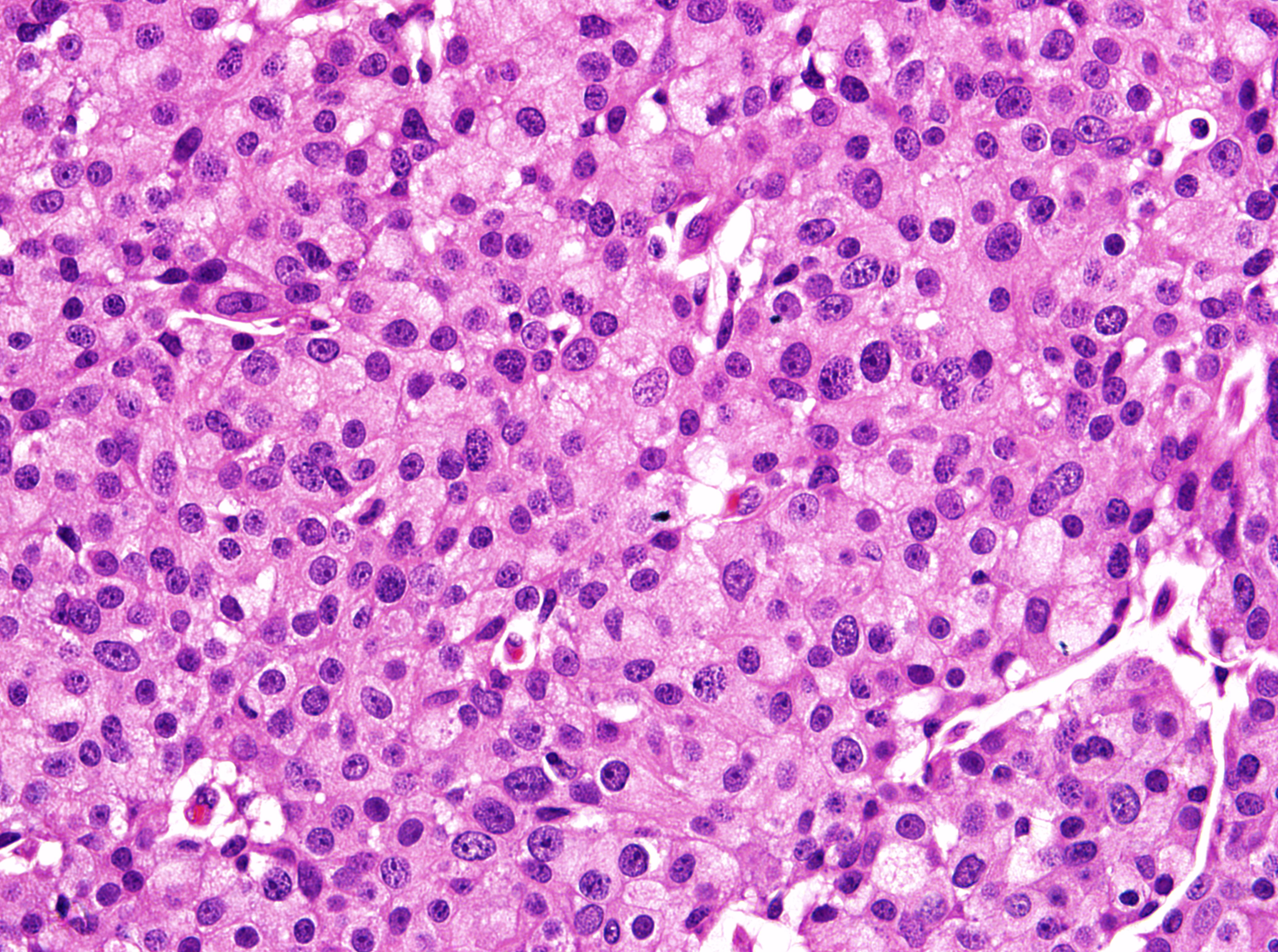 Breast Class Object Detection Dataset by Artificial Intelligence