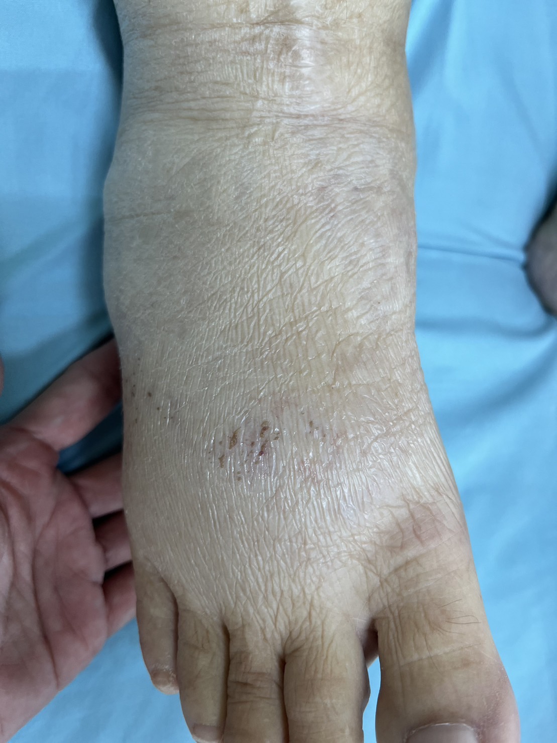 sss Object Detection Dataset and Pre-Trained Model by project1