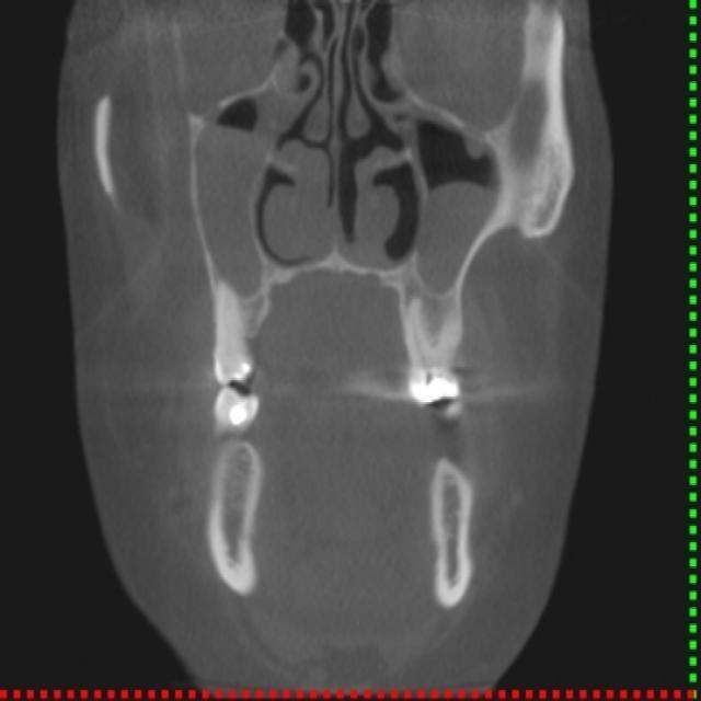 Nose Medical Object Detection Dataset by Nose Area