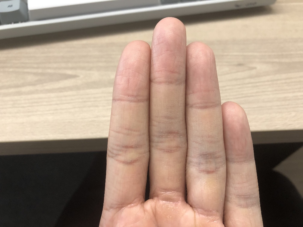 detect-four-fingers-vertical Object Detection Dataset by fingerprint