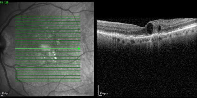 Proj Object Detection Dataset And Pre Trained Model By Charles Williamson