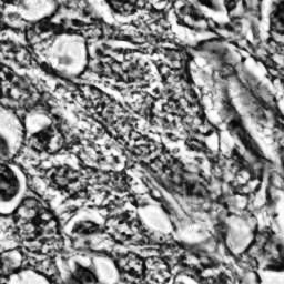 hiseq_grayscale Object Detection Dataset and Pre-Trained Model by 4 HE ...