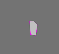 3. TT thuy tinh ban CT Object Detection Dataset by BDPC AI GD2