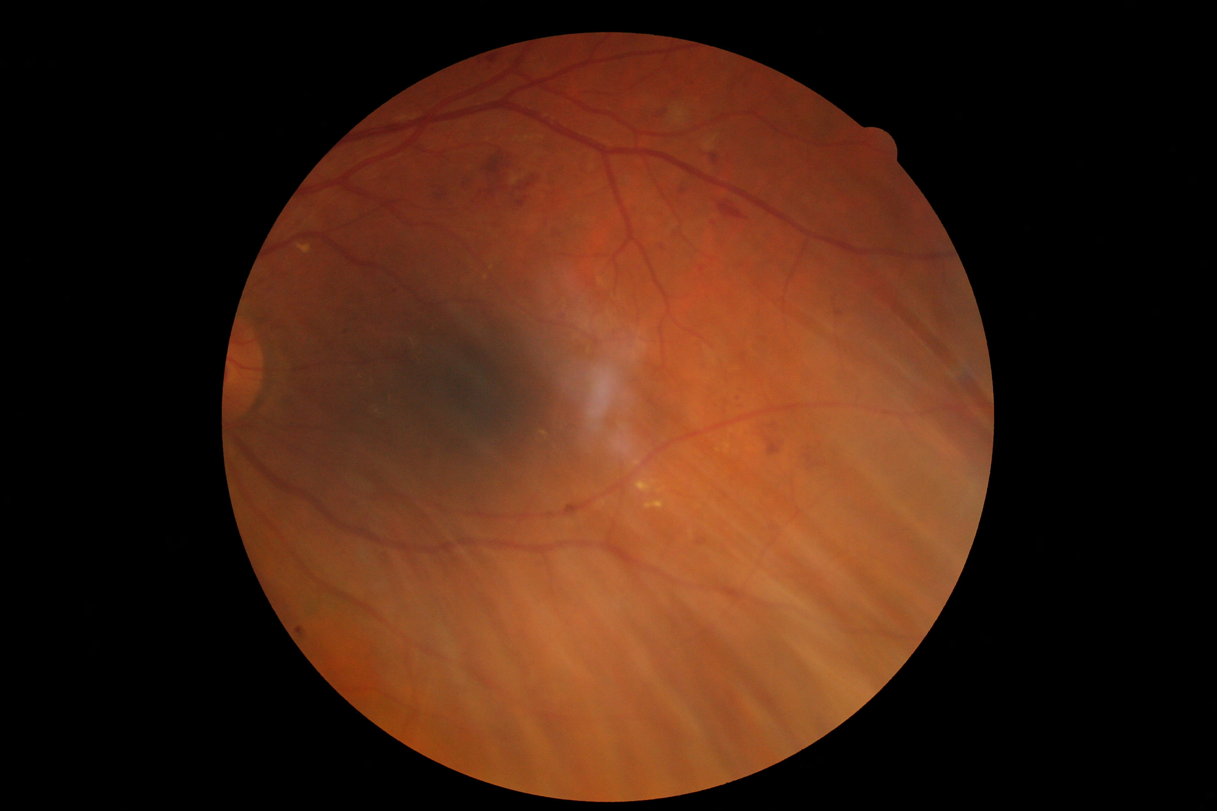 DR Classification Classification Dataset by DATA6000