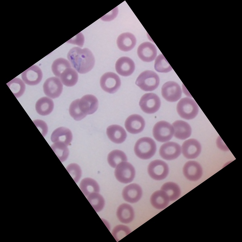 Malaria Stage And Type Detection Object Detection Dataset And Pre