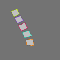 Lumbar-spine Semantic Segmentation Dataset by Faro