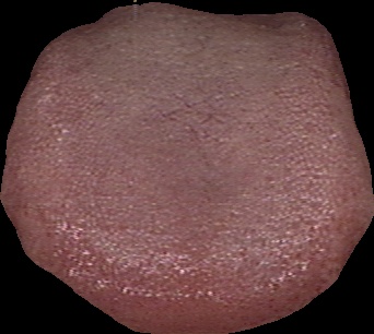 Tongue_Area_Detection_v0.2 Object Detection Dataset by tongue detect