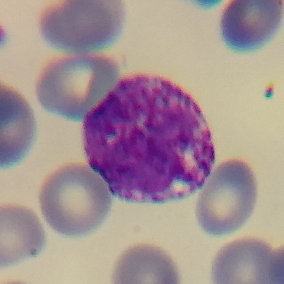 LCBSI-WBC-VALID Classification Dataset by LCBSIWBC