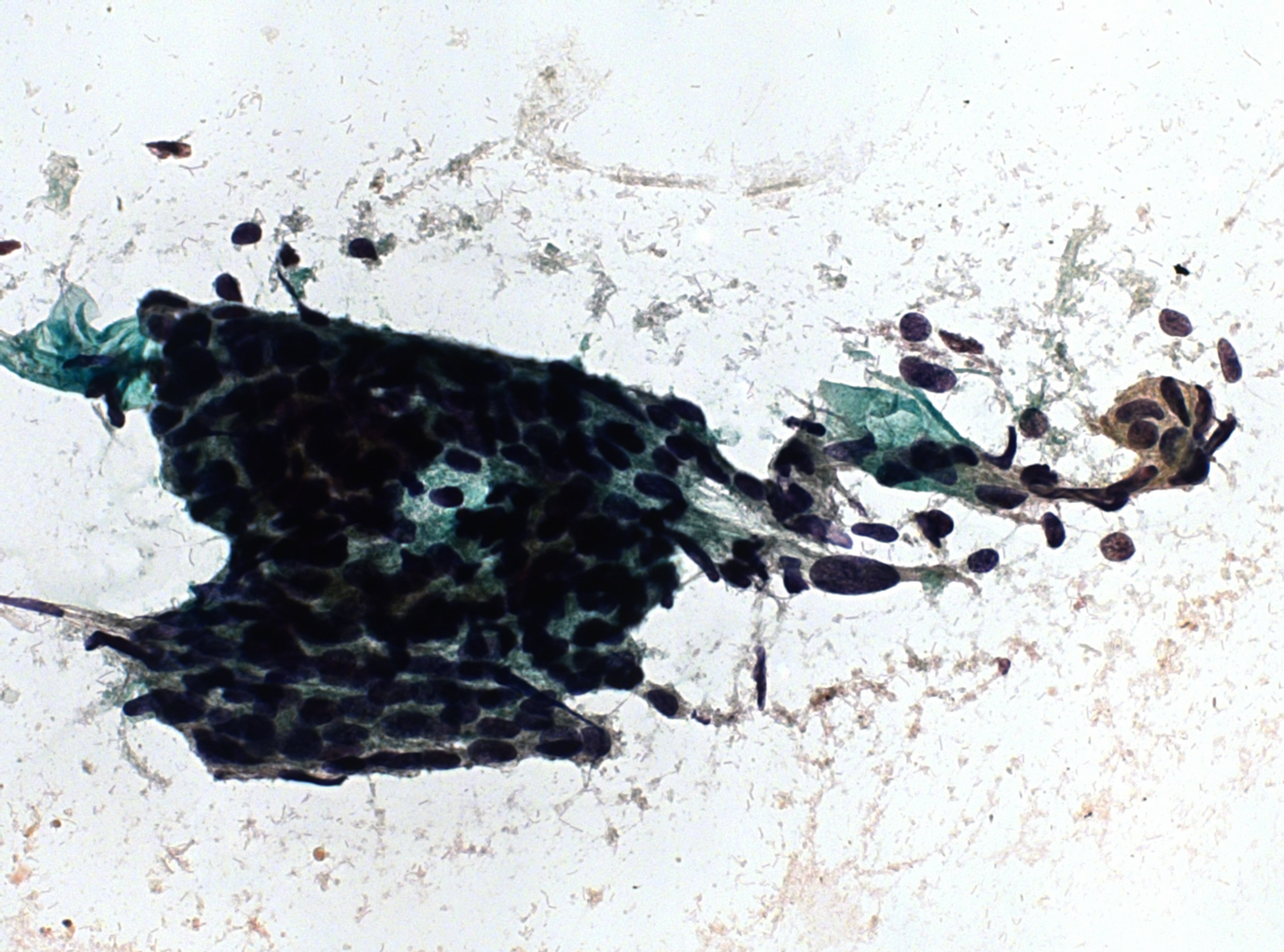 Pap Smear Anomaly Object Detection Dataset By Didierlab