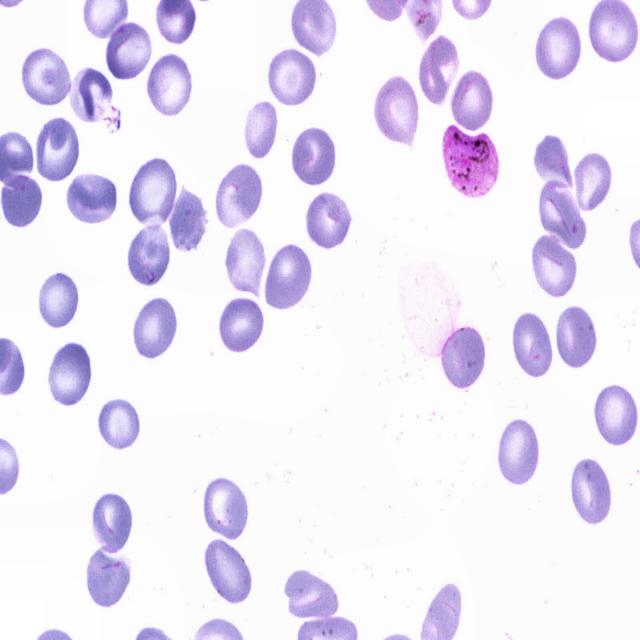 difficult-class Object Detection Dataset by malaria