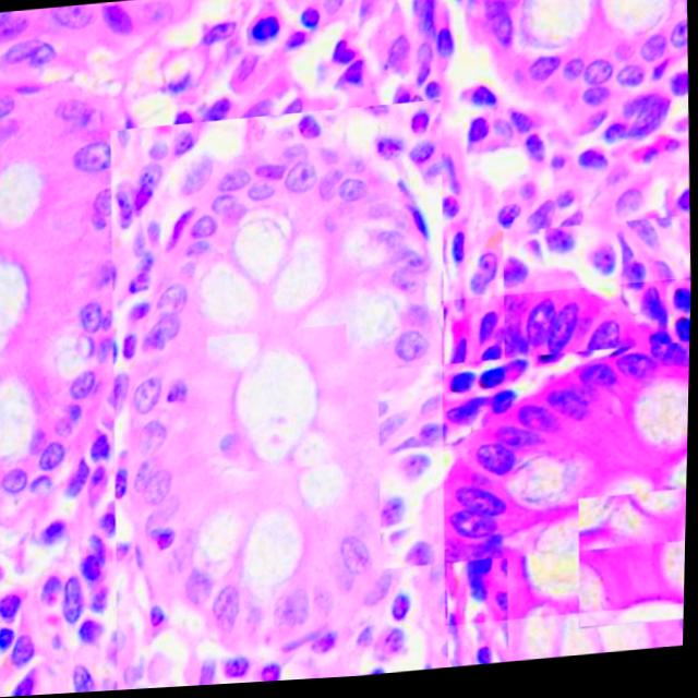 cancer cell Object Detection Dataset by stee