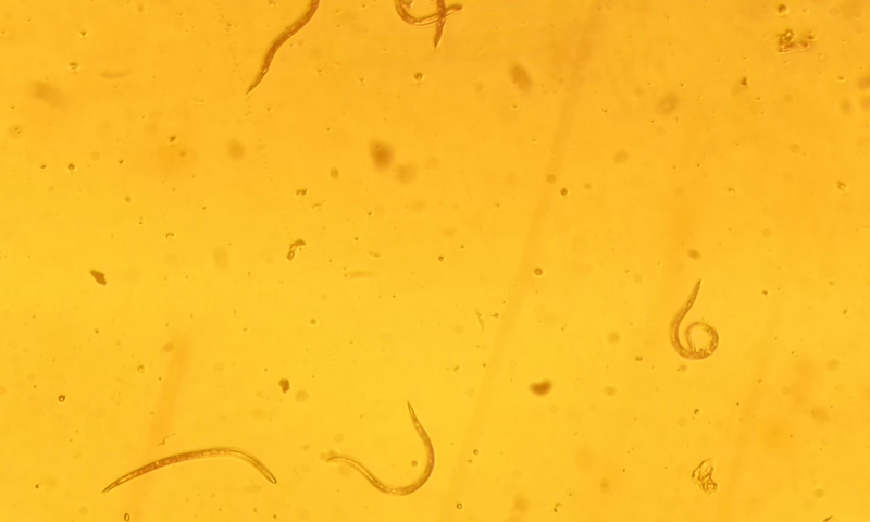 Nematodes Segmentation Object Detection Dataset and Pre-Trained Model by Universidad Peruana de ...